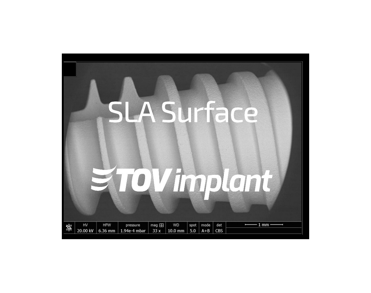 Blog - TOV IMPLANT