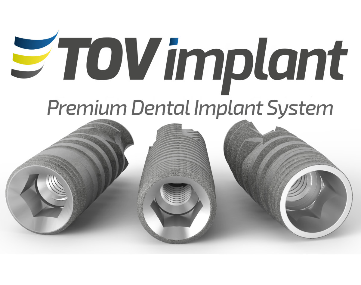 Why choose TOV Implant? - TOV IMPLANT
